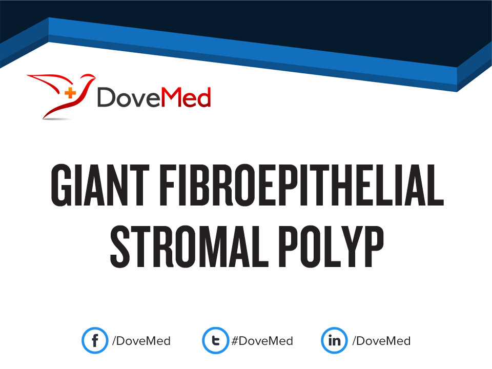 Giant Fibroepithelial Stromal Polyp