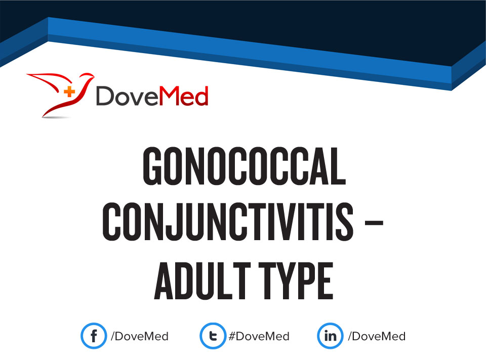 Gonococcal Conjunctivitis – Adult Type