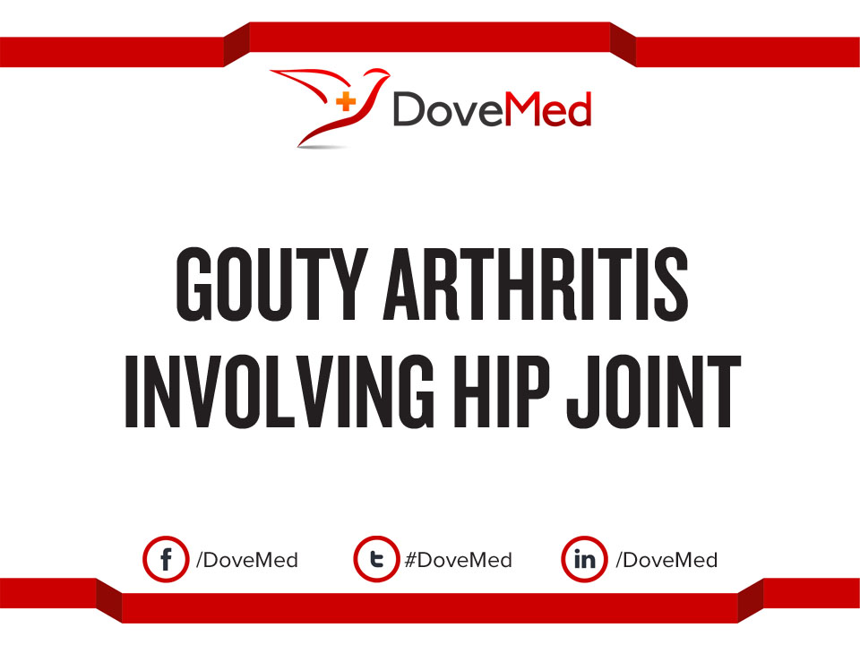 Gouty Arthritis involving Hip Joint