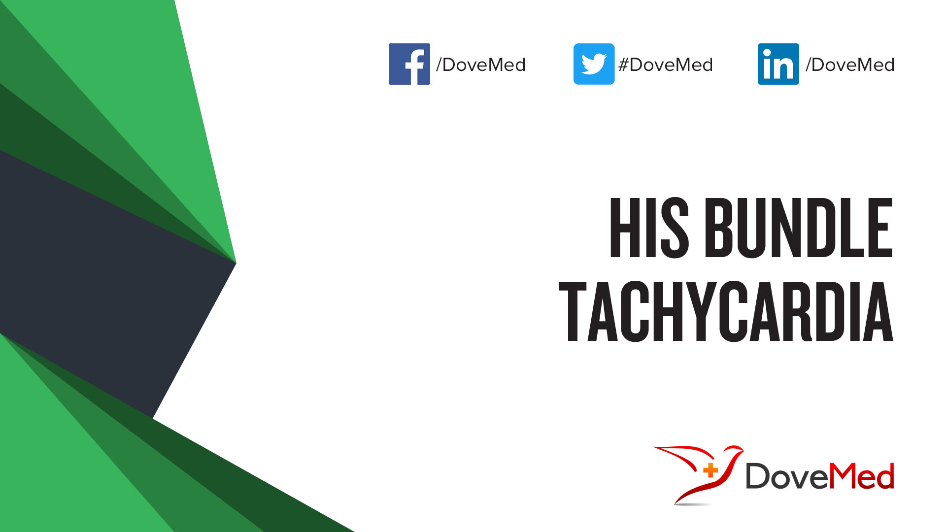 His Bundle Tachycardia