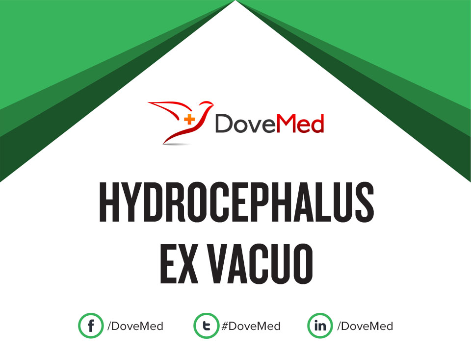 Hydrocephalus Ex Vacuo