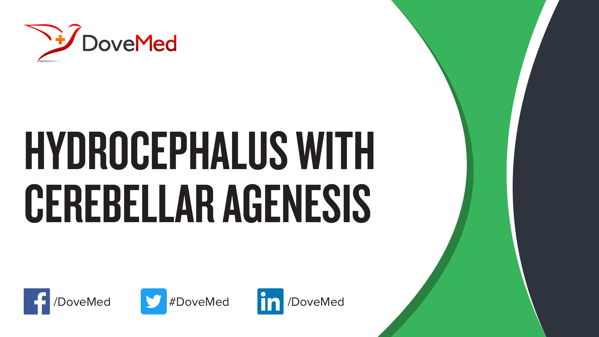 Hydrocephaly-Cerebellar Agenesis Syndrome