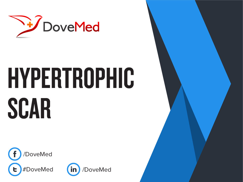 Hypertrophic Scar