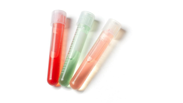 Procalcitonin Blood Test