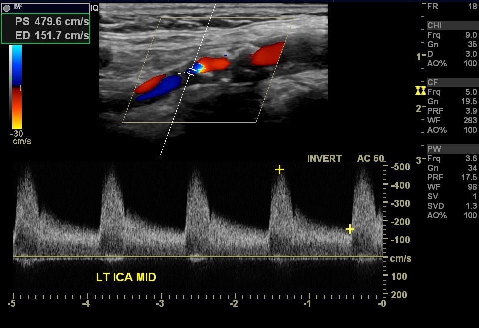 Ultrasound Imaging - Vascular