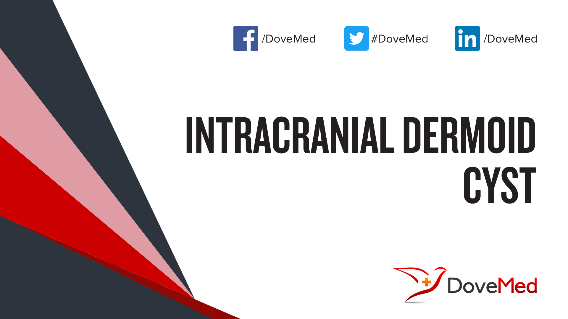 Intracranial Dermoid Cyst