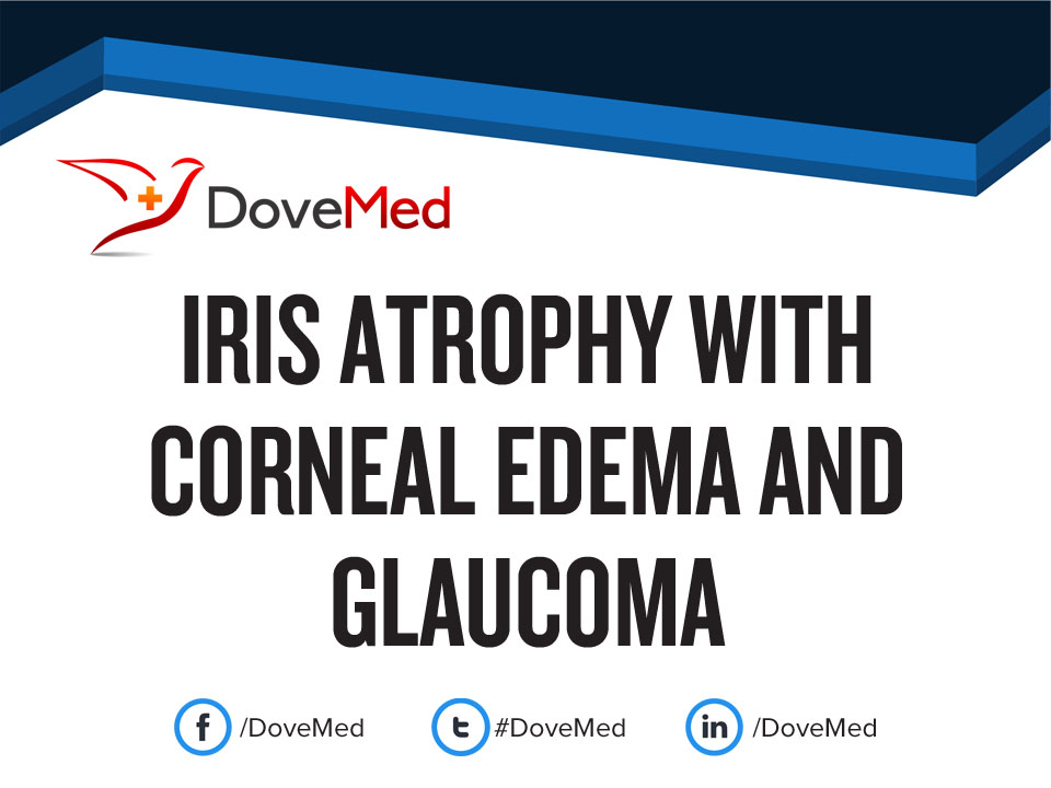 Iris Atrophy with Corneal Edema and Glaucoma