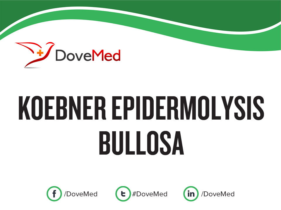 Koebner Epidermolysis Bullosa