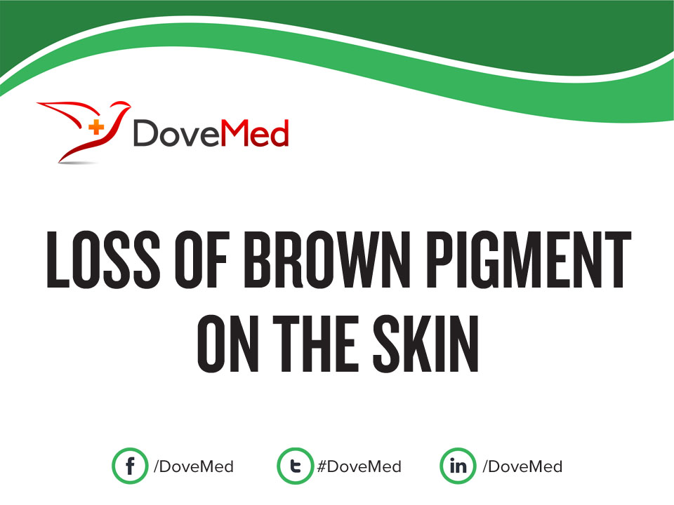 Loss of Brown Pigment on the Skin