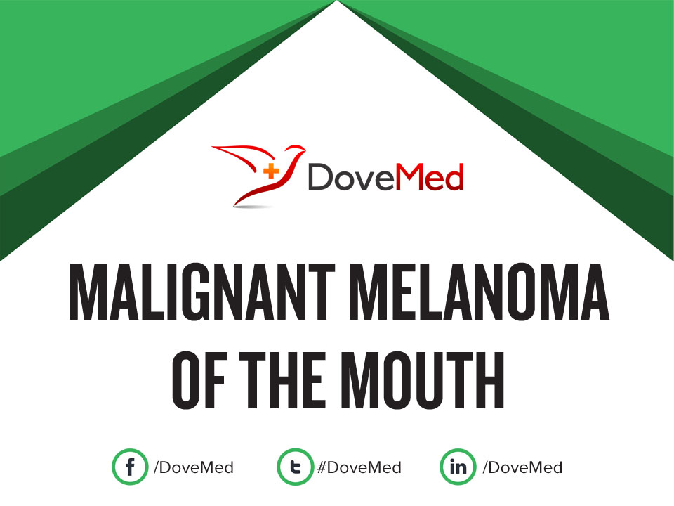 Malignant Melanoma of the Mouth