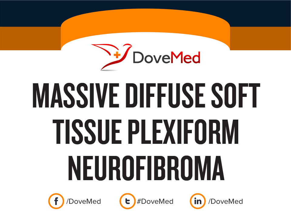 Massive Diffuse Soft Tissue Plexiform Neurofibroma