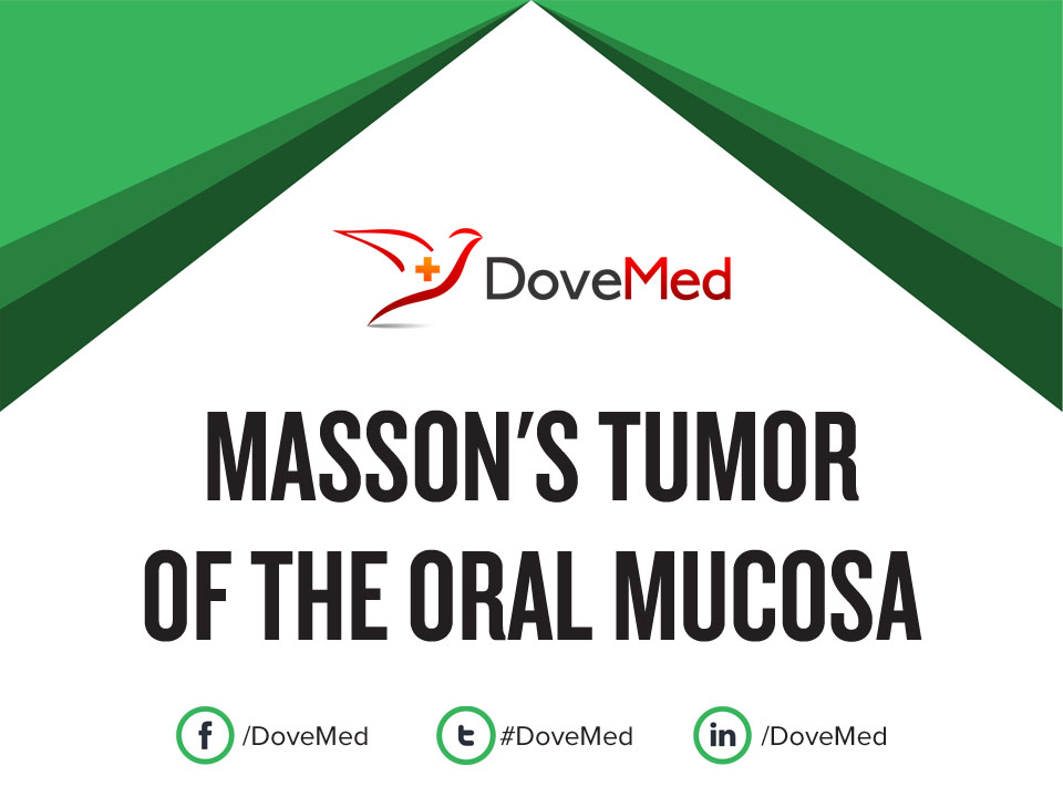 Masson's Tumor of the Oral Mucosa