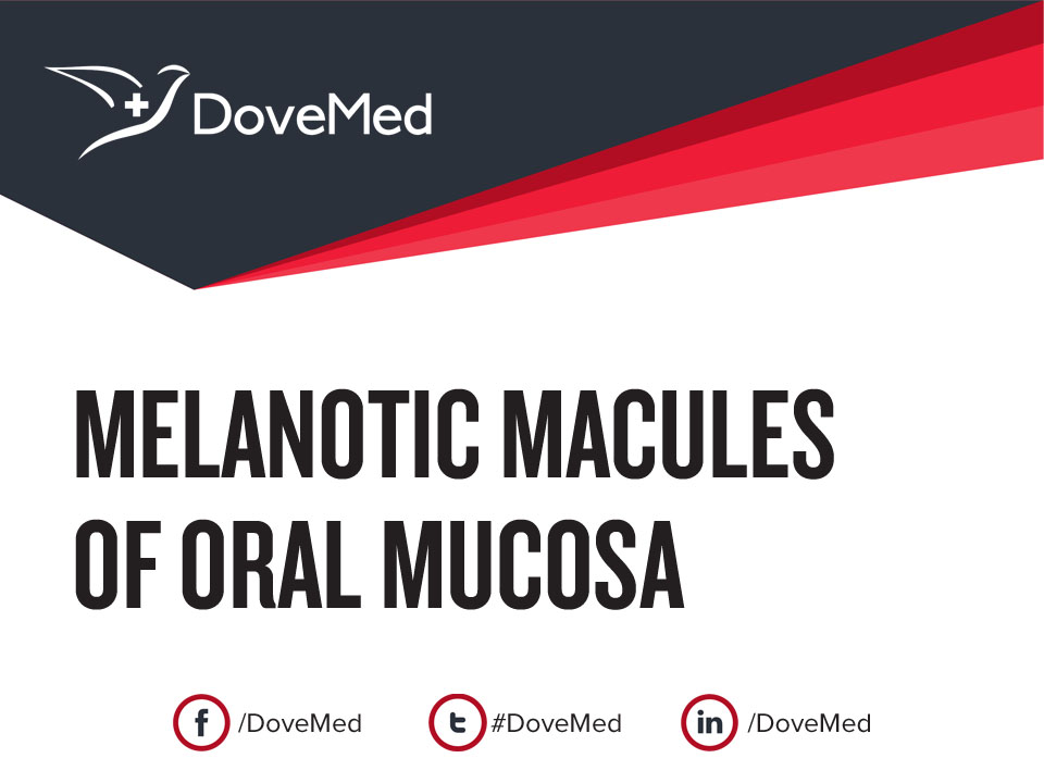 Melanotic Macules of Oral Mucosa
