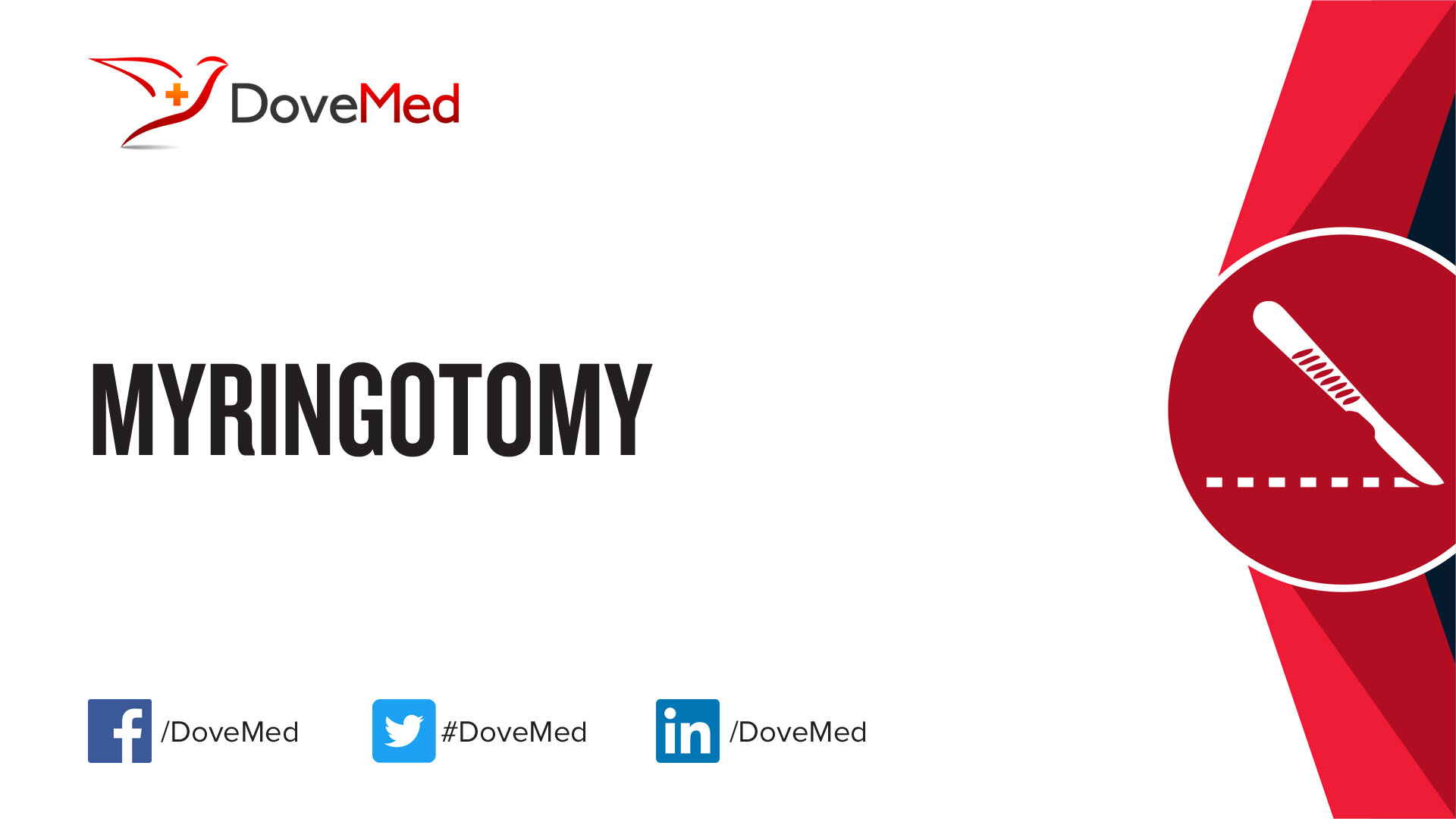 Myringotomy