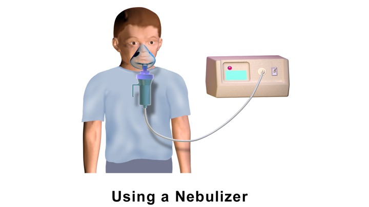 Nebulization