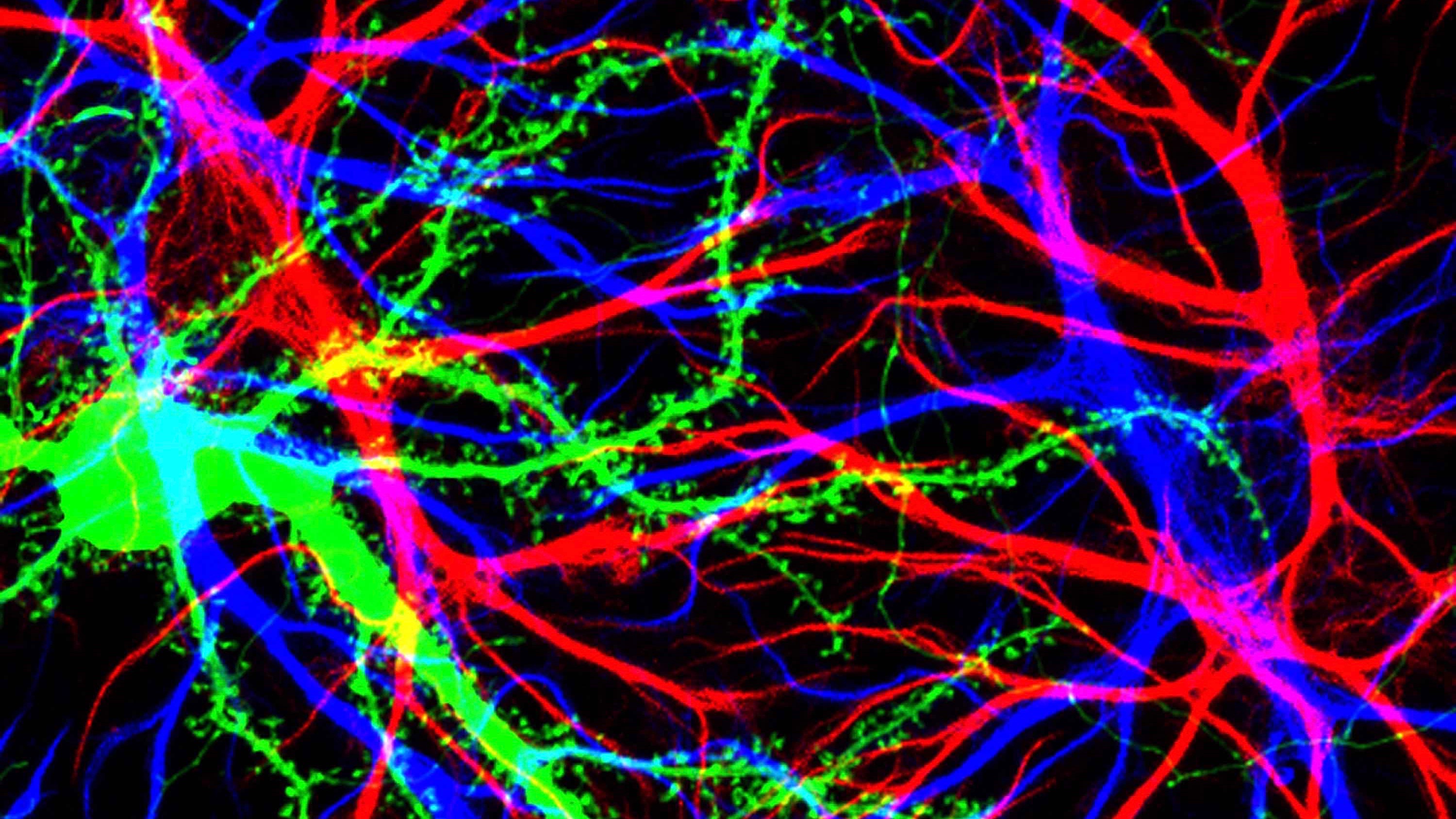 Brain Cell Simulations Show Critical Tipping Point For Swelling