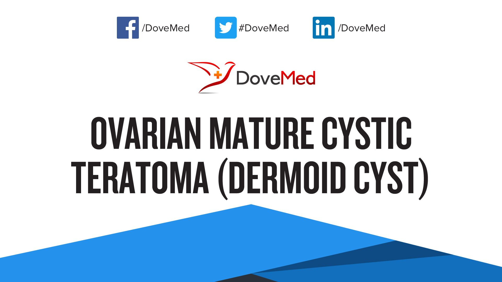 Ovarian Mature Cystic Teratoma (Dermoid Cyst)