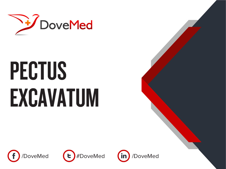Pectus Excavatum