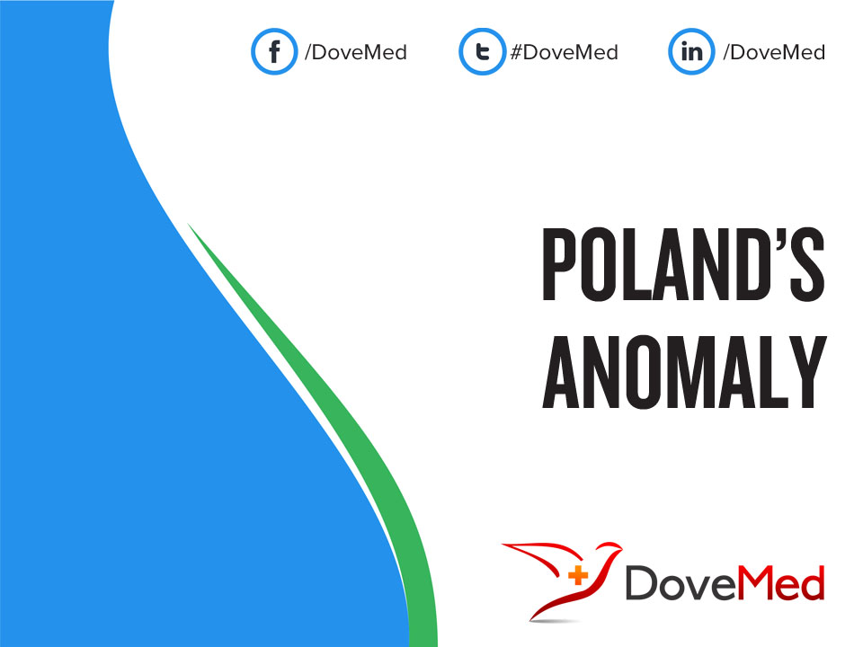 Poland’s Anomaly