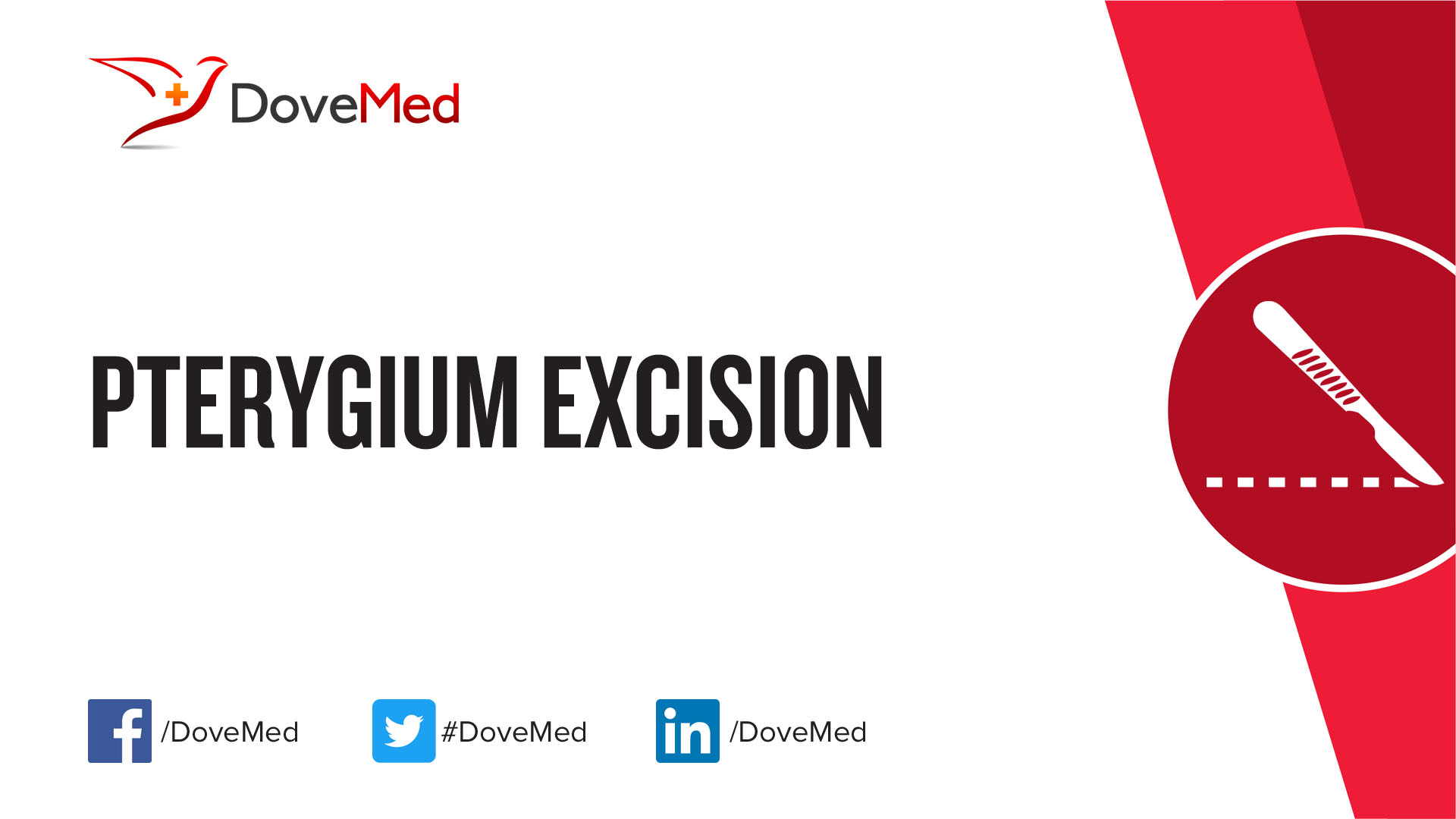 Pterygium Excision