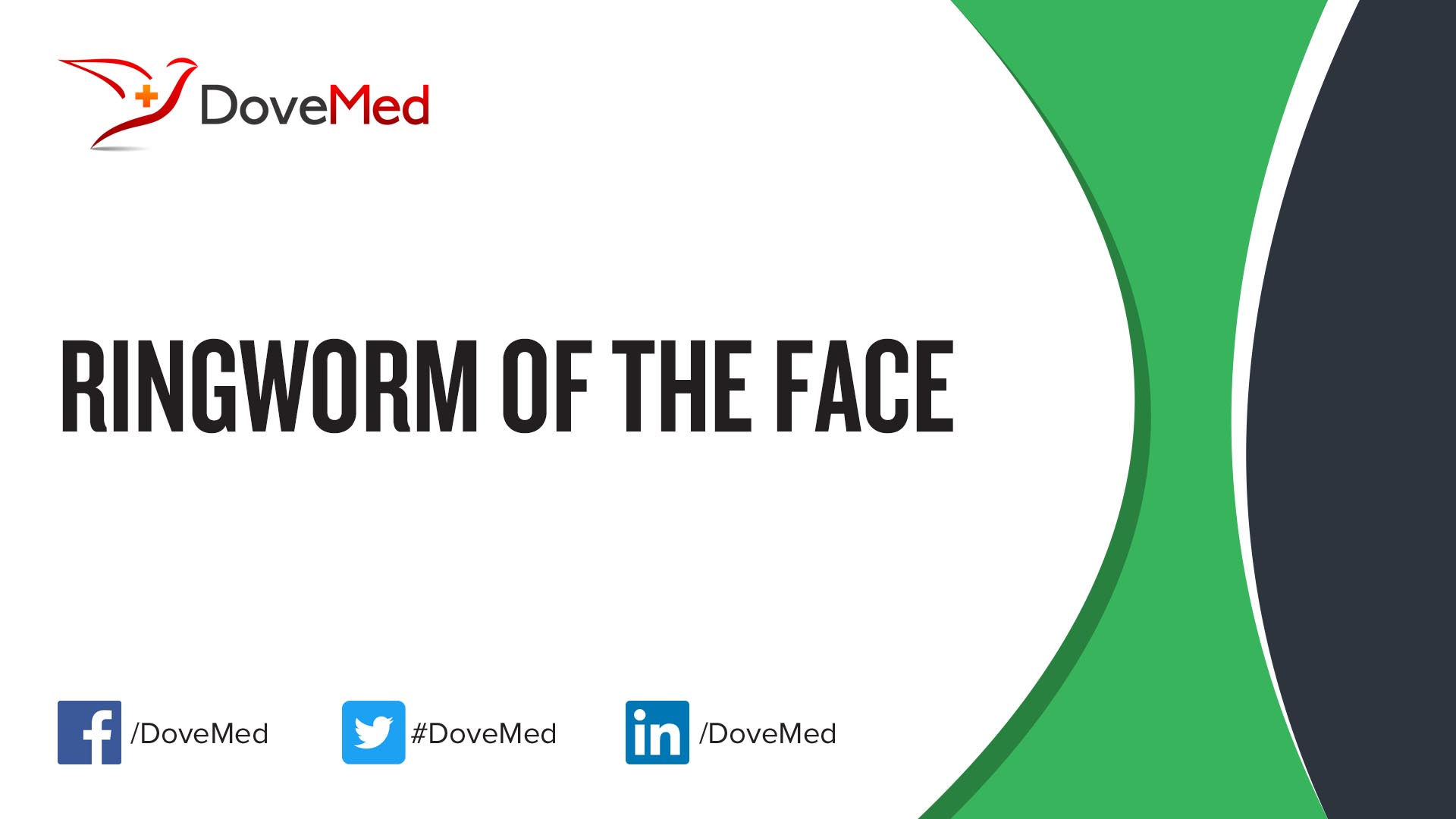 Ringworm Of The Face