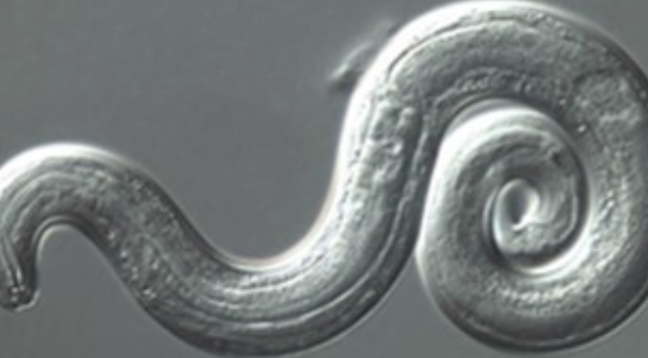 Infant Hospitalized For Rare Brain Parasite In Hawaii
