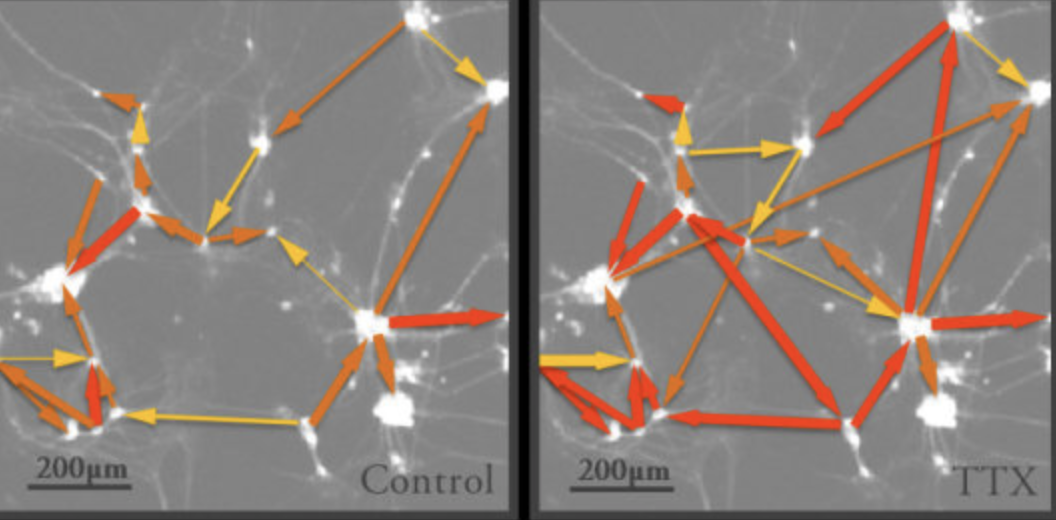 What Happens When Nerve Cells Stop Working?