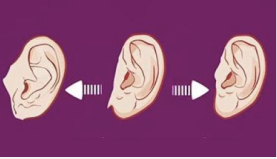 Do Your Ears Hang Low? The Complex Genetics Behind Earlobe Attachment
