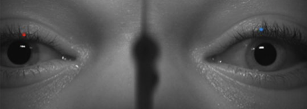 Neurological Assessment In The Blink Of An Eye?