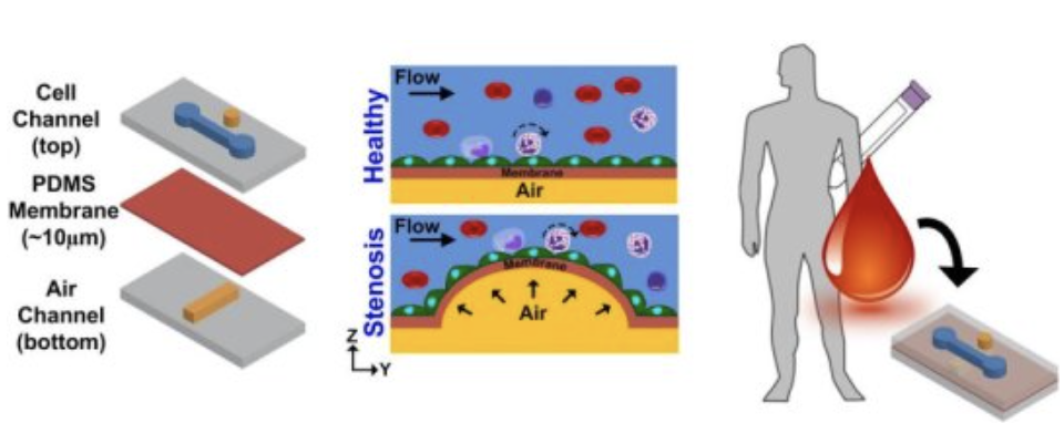 An Organ-on-a-chip Device That Models Heart Disease