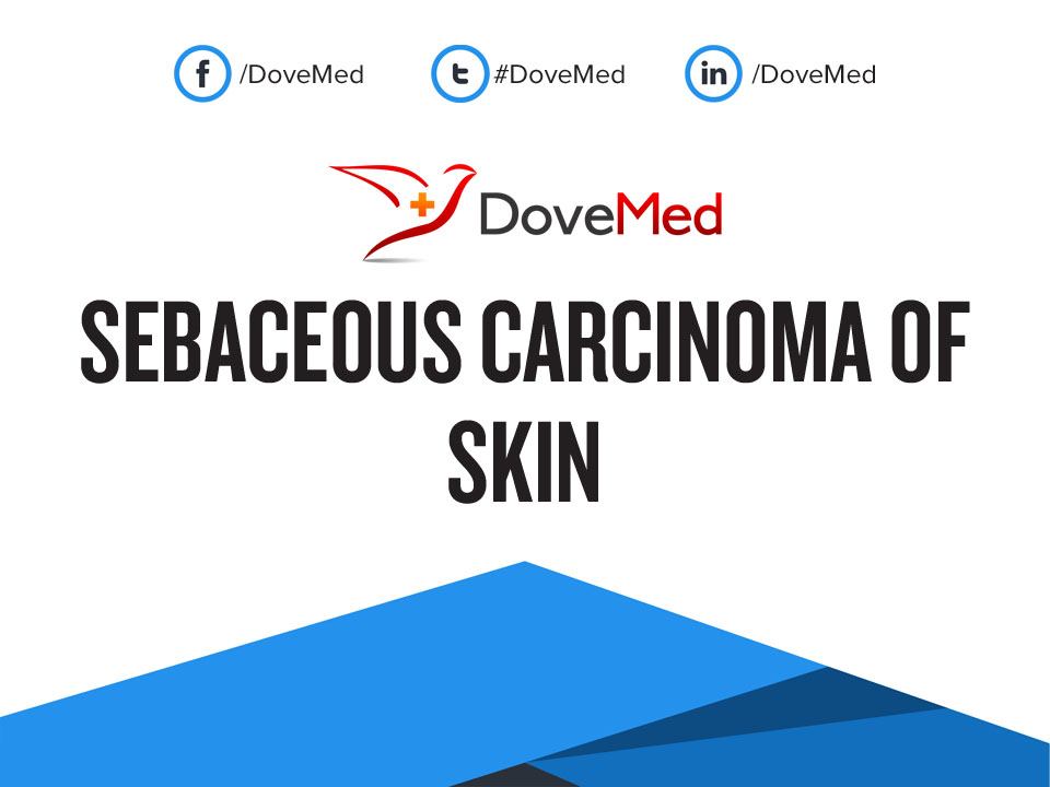 Sebaceous Carcinoma of Skin