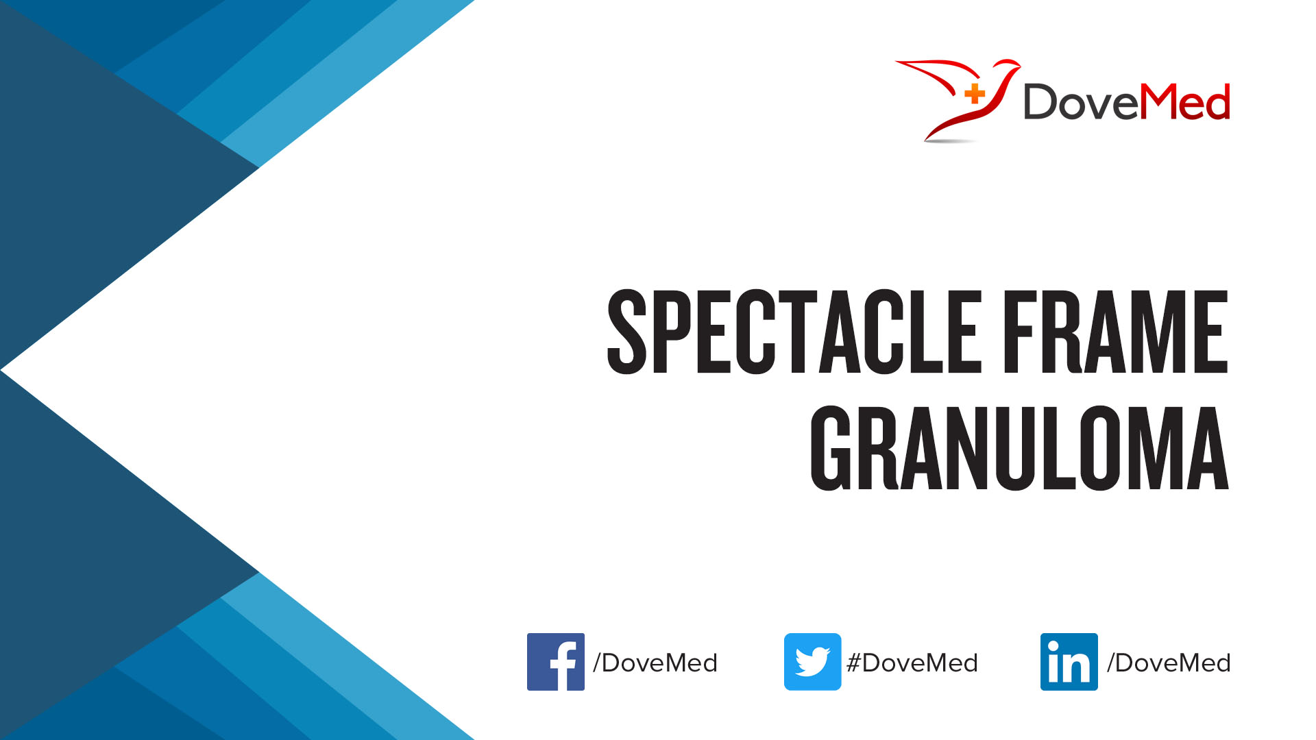 Spectacle Frame Granuloma