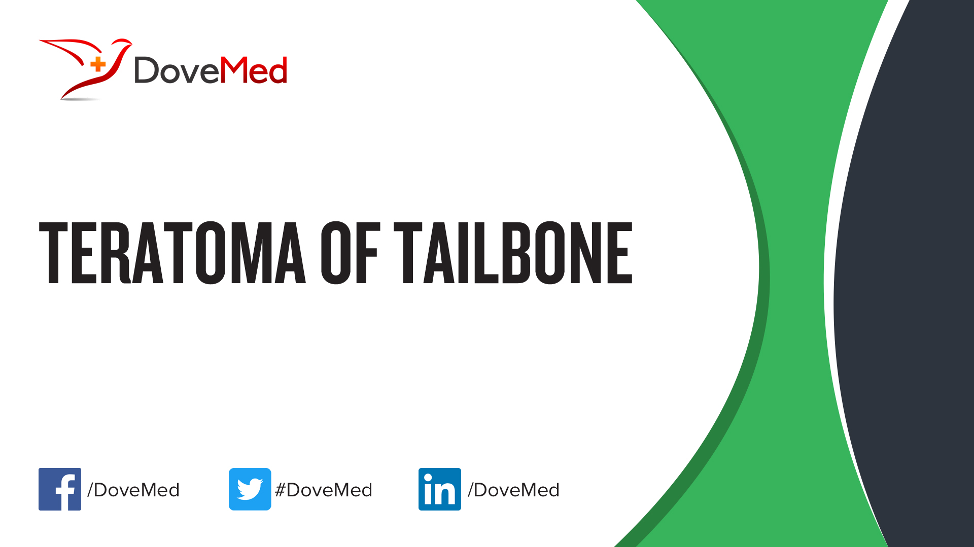 Teratoma of Tailbone