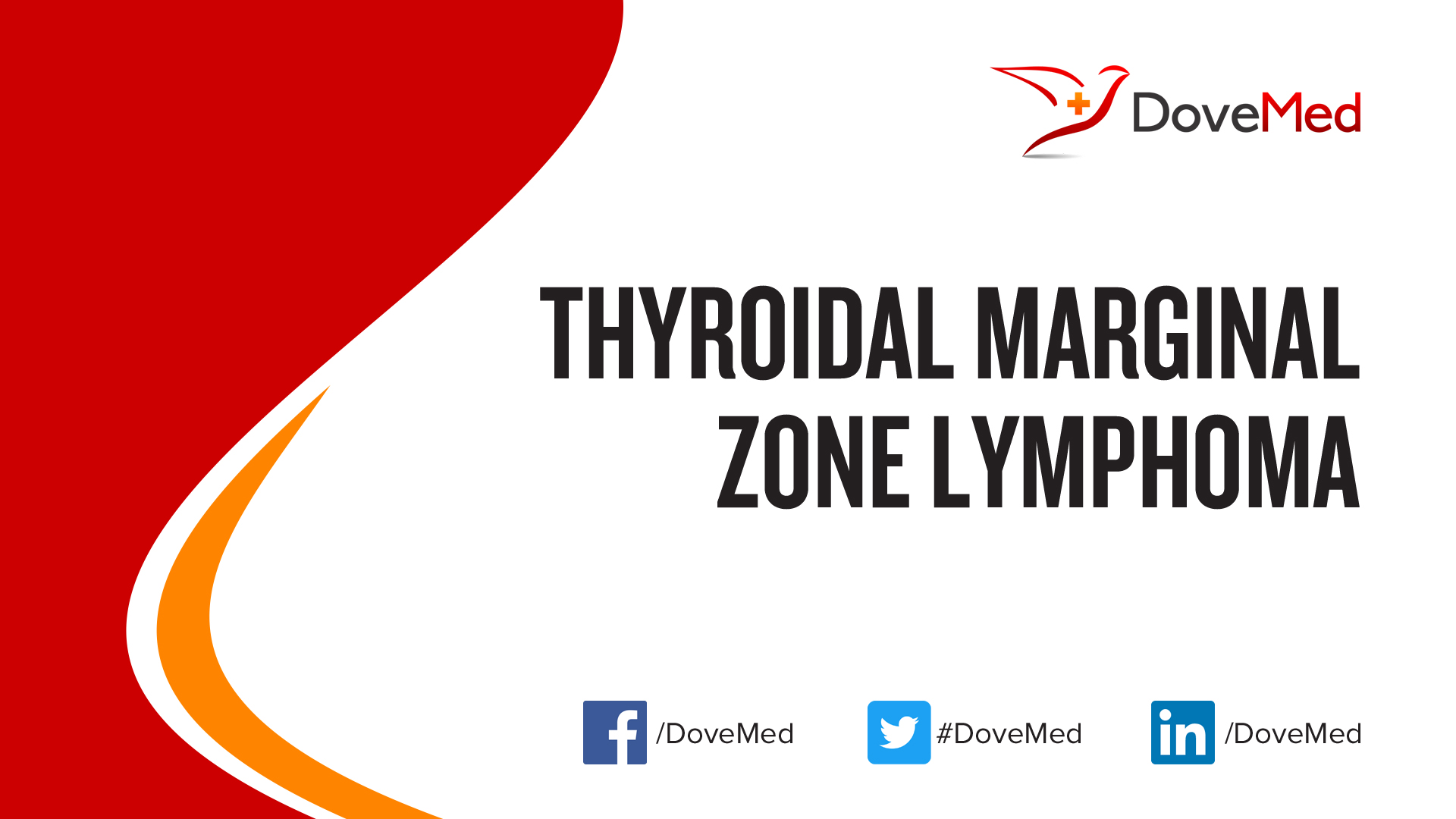 Thyroidal Marginal Zone Lymphoma