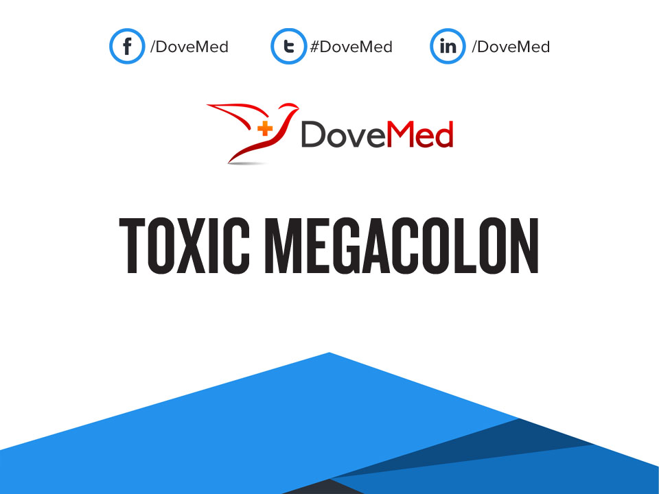 Toxic Megacolon toxic-megacolon