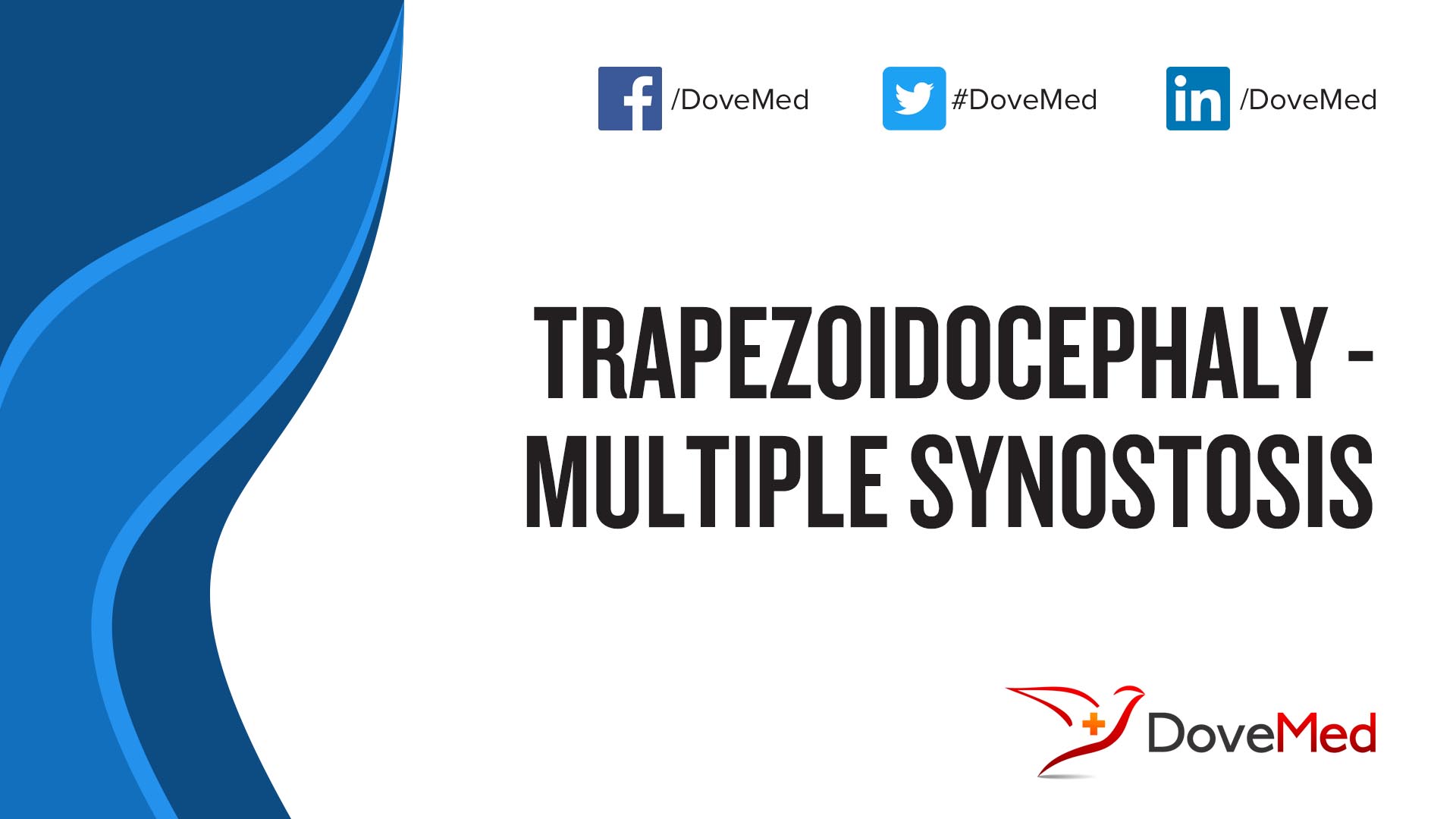 Trapezoidocephaly - Multiple Synostosis Syndrome