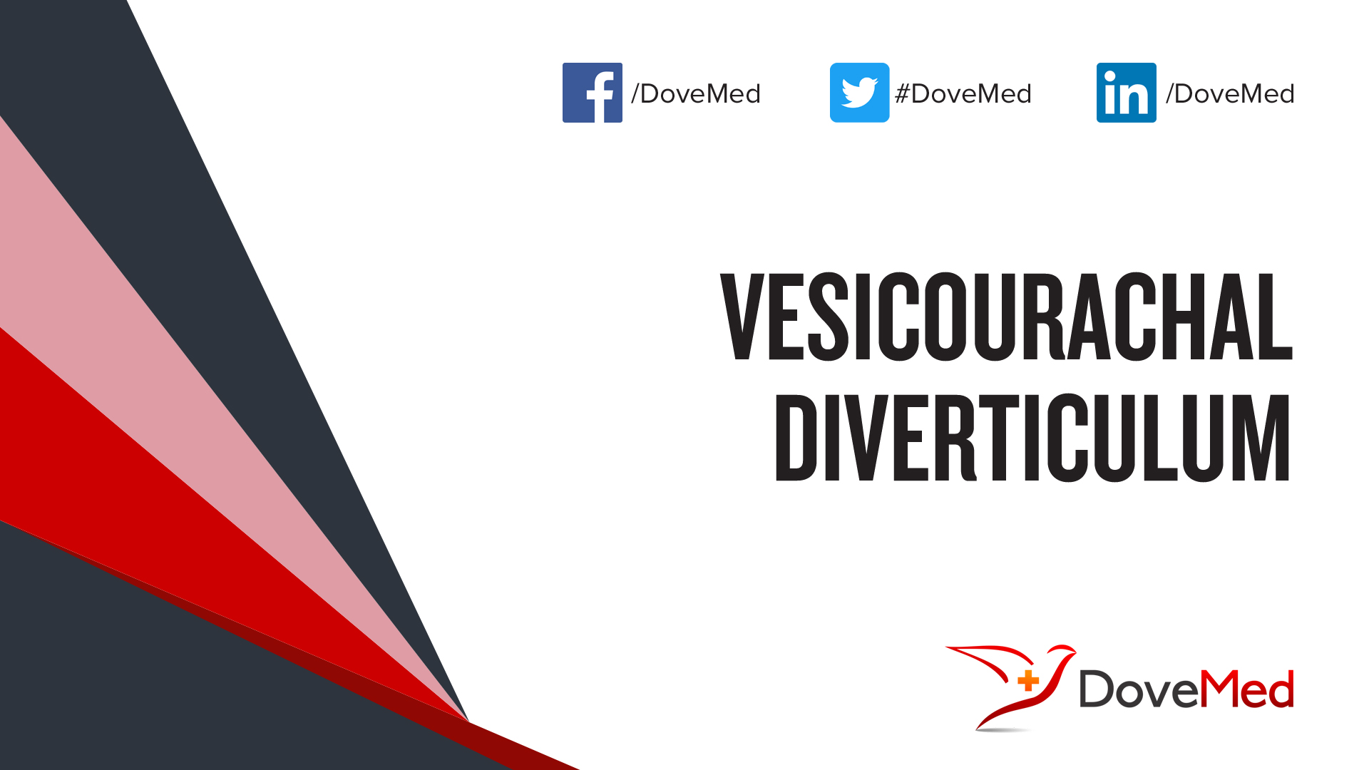 Vesicourachal Diverticulum