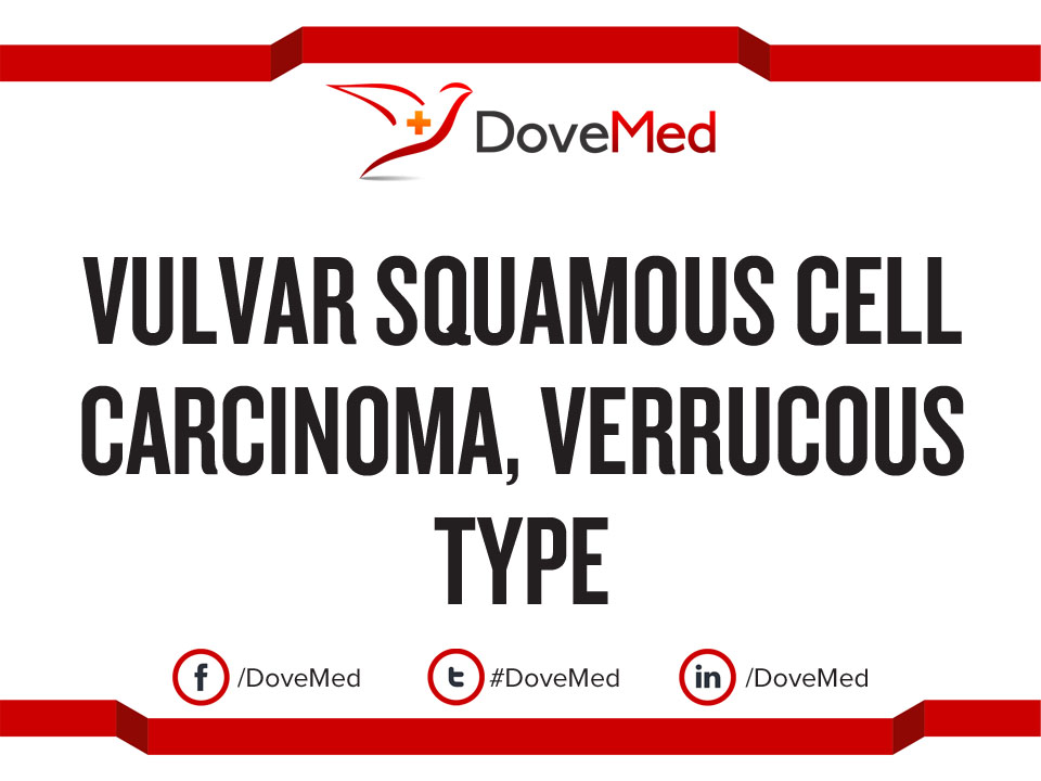 Vulvar Squamous Cell Carcinoma, Verrucous Type