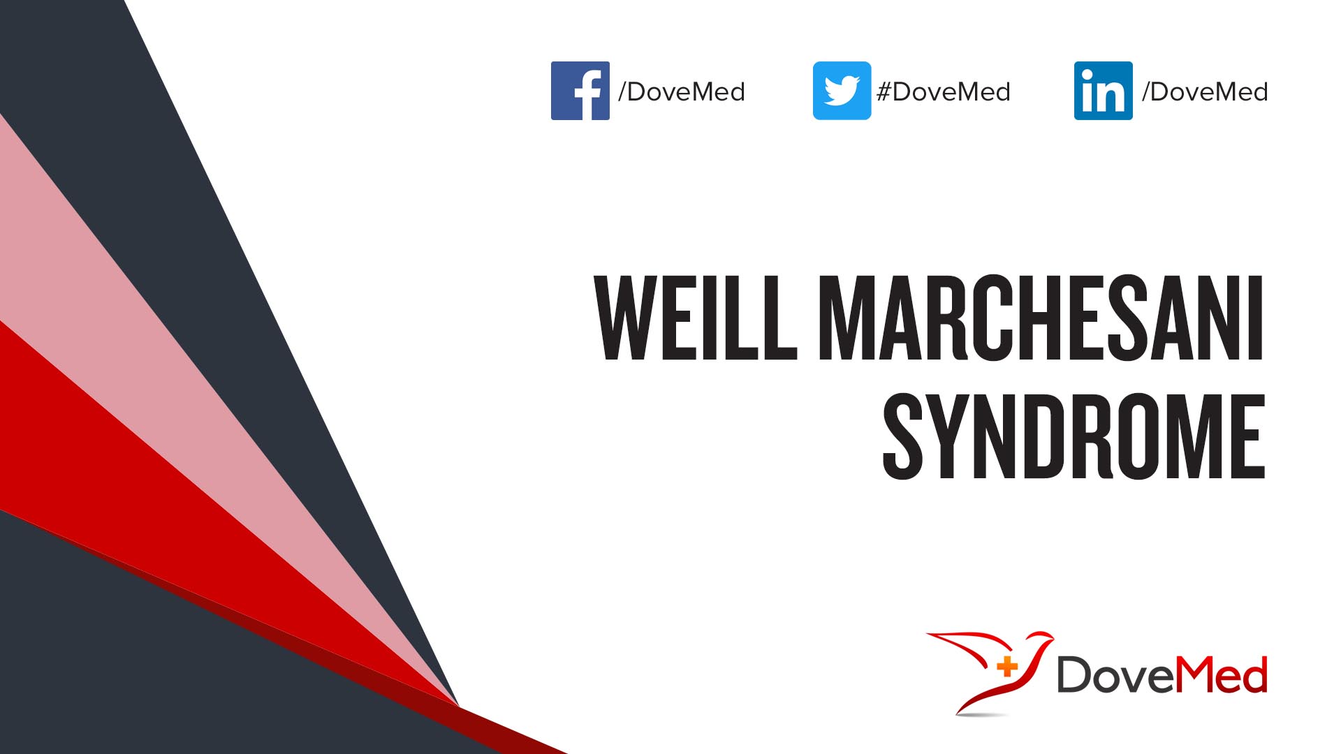 Weill Marchesani Syndrome