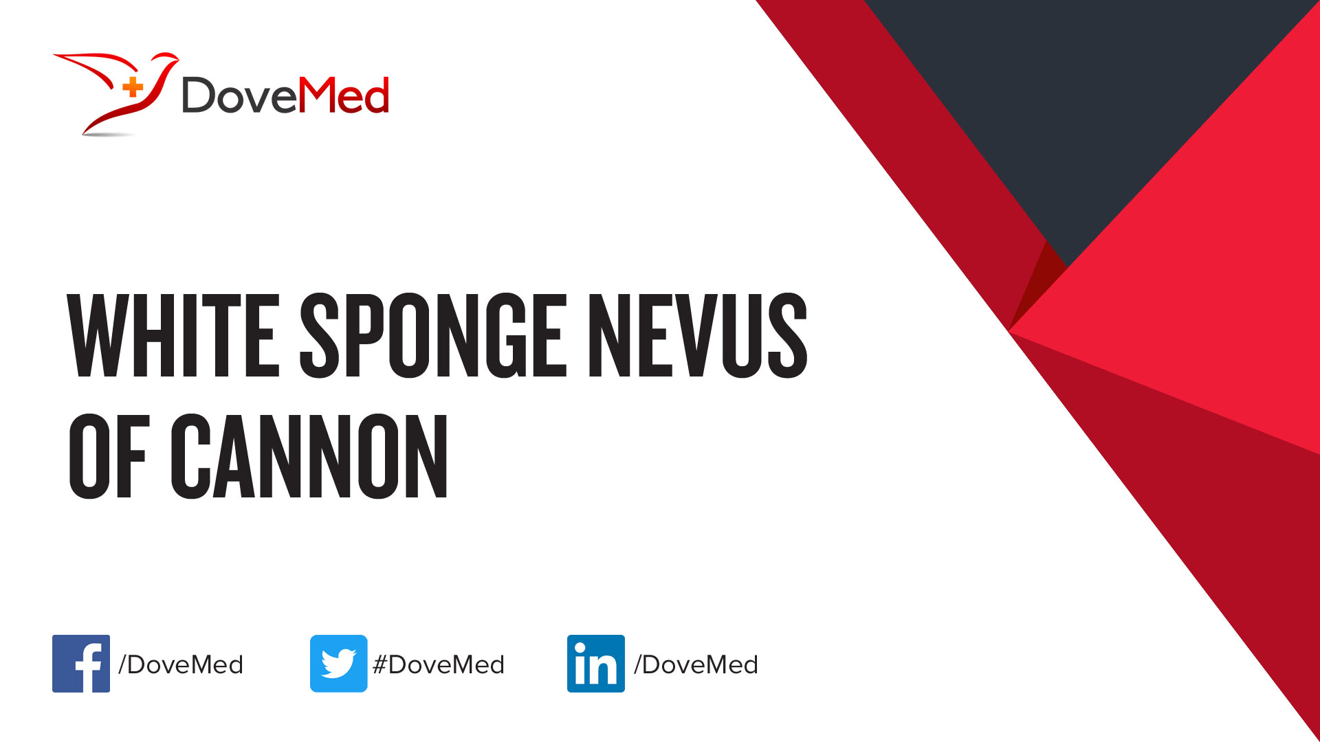 White Sponge Nevus of Cannon