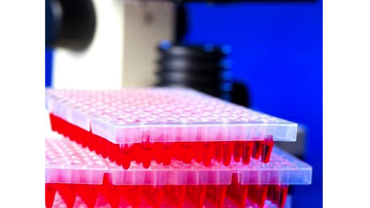 Gentamicin Trough Level Blood Test